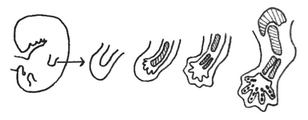 Les synostoses - ORTHOPEDIE-PEDIATRIQUE.COM